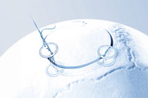 Crânio – DimensionCare